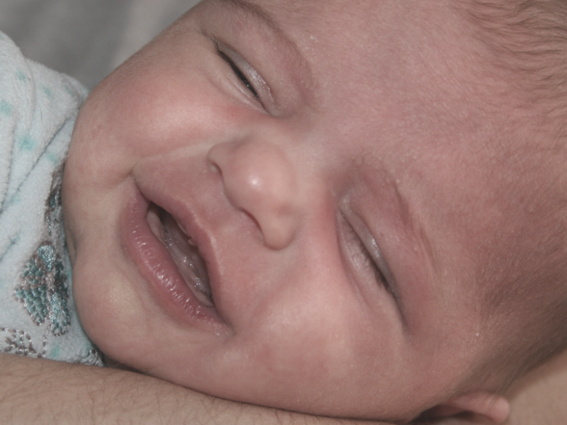 De mazelen: symptomen, besmettelijkheid, behandeling, vaccinatie