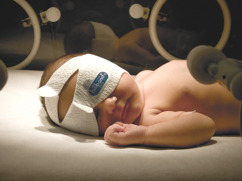 Schisis/ hazenlip bij kinderen: oorzaken, onderzoek, behandeling